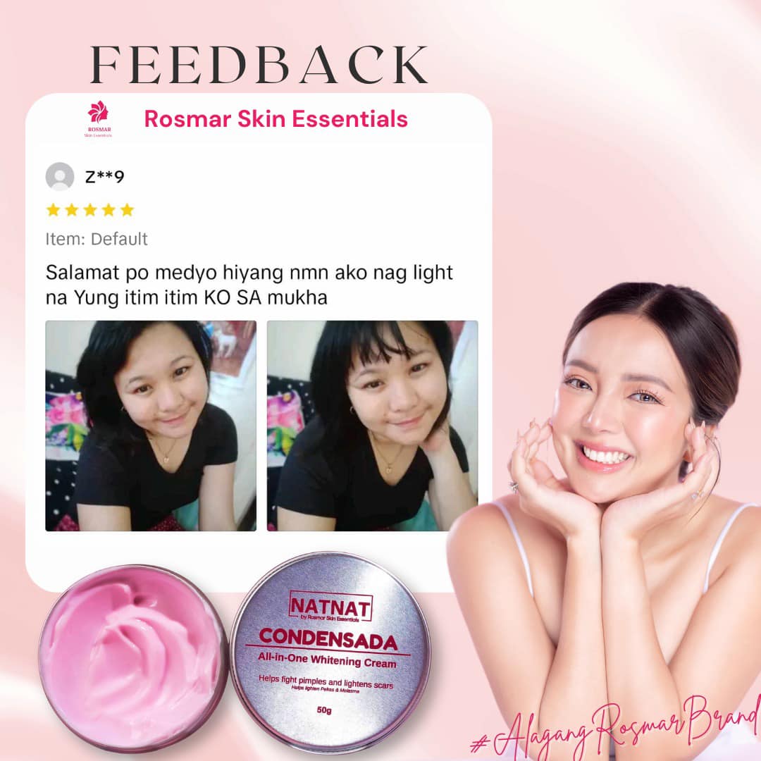 Natnat Condensada PEKAS MELASMA all in one whitening cream - ROSMAR SKIN ESSENTIALS